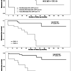 Metastasis-free survival analyses according to the Grading system for ...
