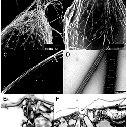 Ostreopsis cf. ovata trichocysts: Scanning and transmission electron ...