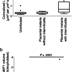 LC3B and LAMP1 puncta colocalization measured as the volume of ...