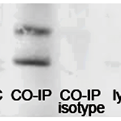 Co-immunoprecipitation of SOCS-1 with CYTIP.
