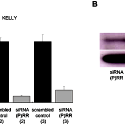 Confirmation of siRNA efficacy in KELLY cells.