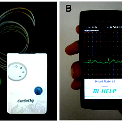 A portable system for ECG monitoring on the mobile phone.