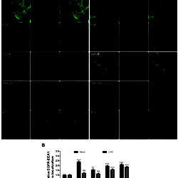 EGFR co-localization with EEA1 after clathrin knockdown.