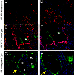 Alveolar type II (ATII) cells are absent from the pseudostratified ...