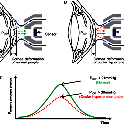 Working principle of the intraocular pressure (IOP) measurement using ...