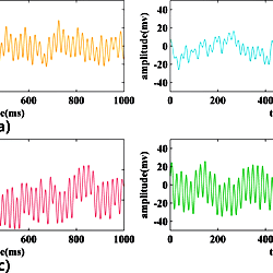 Driver fatigue detection through multiple entropy fusion analysis in an EEG-based system - Fig 3