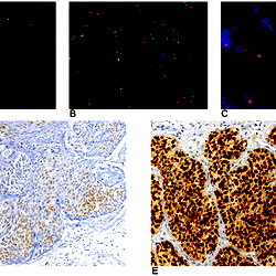 SOX2 FISH and SOX2 IHC.
