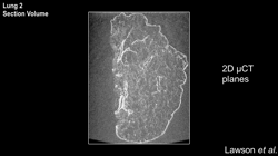 Supplementary Video 2. Summary of lung tissue 2 µCT and segmentation in 2D & 3D. from ...