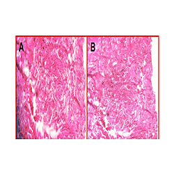 Evaluation of anti-inflammatory impact of dexamethasone-loaded PCL-PEG ...