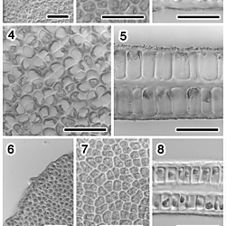 Systematics of green algae resembling Ulva conglobata, with a ...