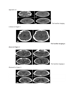 The impact of visual and motor skills on ideational apraxia and ...
