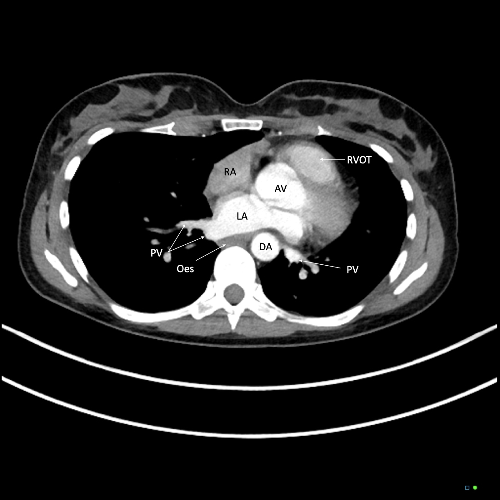 Imaging for Students