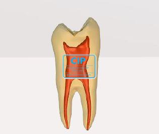 Voor en door tandartsen | CIP Mondzorg