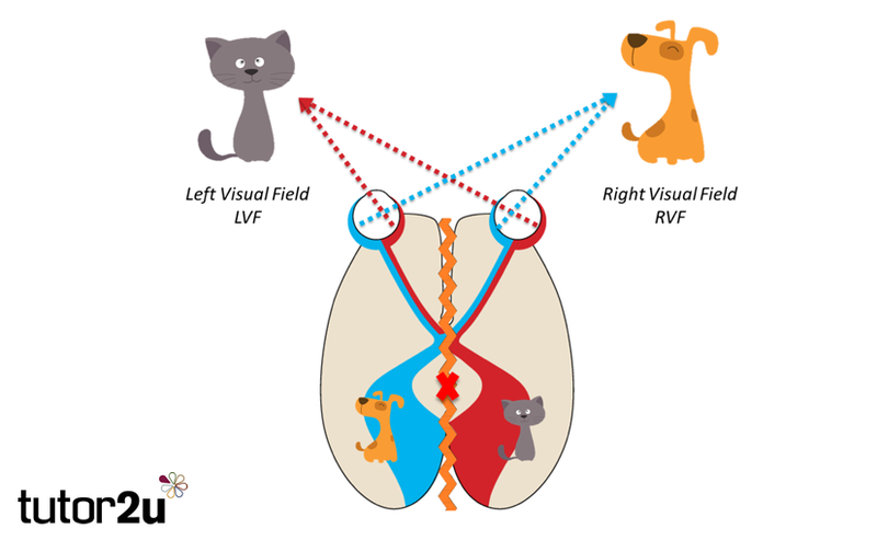 Biopsychology: Hemispheric Lateralisation & Split Brain… | tutor2u